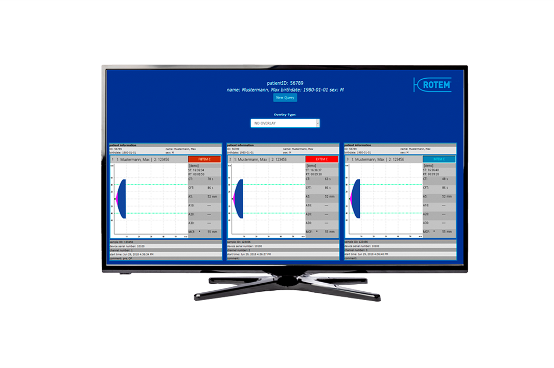 GEM® Hemochron™ 100 | Werfen em Brasil