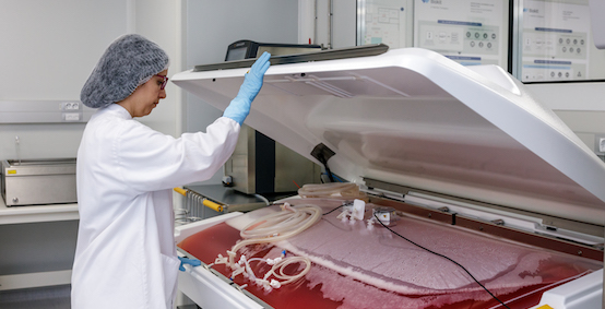 Clinical sample Biobanking for Immunoassay research and development | Werfen Immunoassay